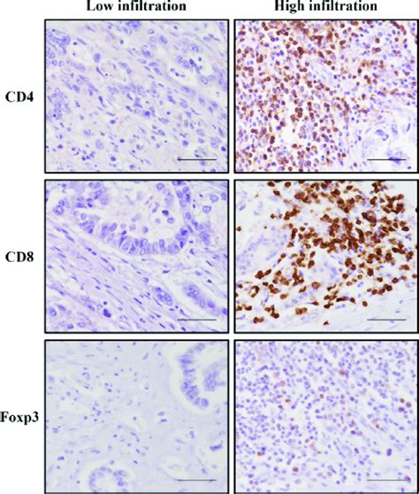Representative Immunohistochemical Staining Of Cd4 Cd8 And Foxp3 T