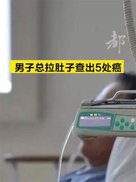 男子总拉肚子查出5处癌 食管 肿瘤 新浪新闻