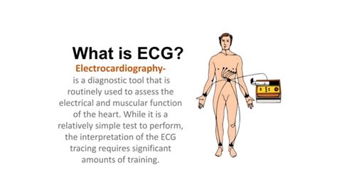 Ecg Ppt Ppt
