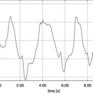 Accelerometer Bias Estimates With IMS EKF Download Scientific Diagram