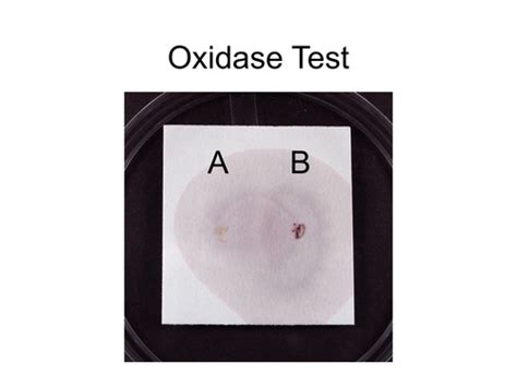 Catalase And Oxidase Tests Flashcards Quizlet