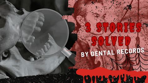 Three Most Famous Cases Solved By Forensic Dentistry