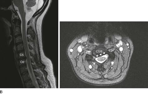Spine Clinical Gate