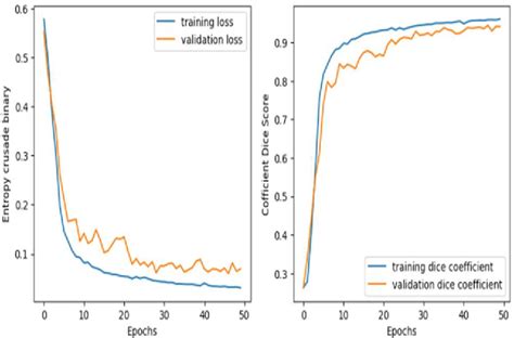 Figure 1 From Deep Learning Based Thoracic Disease Detection And Localization In Chest