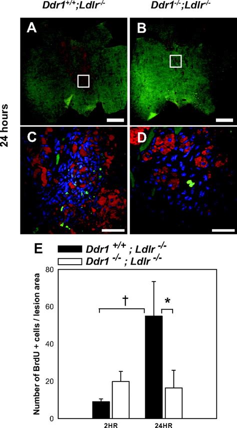 Discoidin Domain Receptor 1 On Bone Marrowderived Cells Promotes
