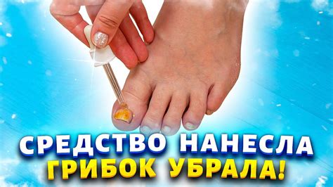 ПРОЩАЙ ГРИБОК! Это ЯДРЁНОЕ МАСЛО разъест весь грибок с ногтей и кожи ...