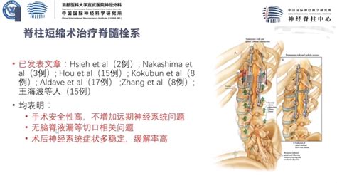 首都医科大学宣武医院段婉茹副教授：脊柱短缩术治疗复发性脊髓拴系综合征病例分析 脑医汇