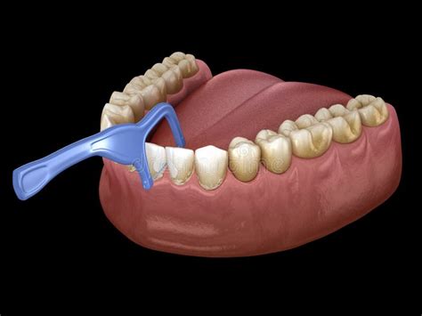 Oral Hygiene Using Toothpick Dental Floss To Remove Food Stuck From