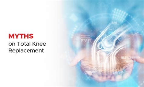 Myths On Total Knee Replacement