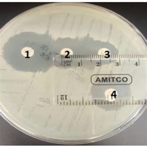 Double Disc Synergy Test DDST Confirming ESBL Producing E Coli