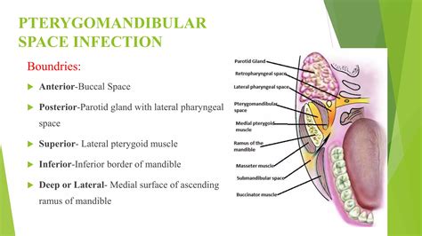 Masticatory Space Infection Pptx