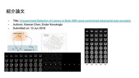 Unsupervised Detection Of Lesions In Brain Mri Using Constrained