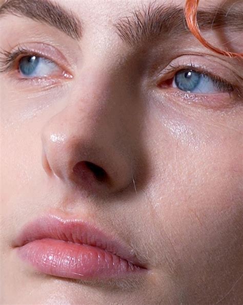 Sicky — Orla
