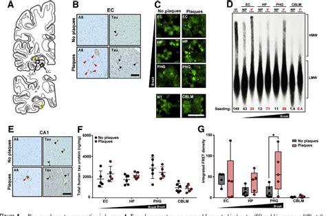 Figure 1 From Enhanced Tau Aggregation In The Presence Of Amyloid β Semantic Scholar