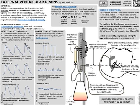 External Ventricular Drain — Icu One Pager