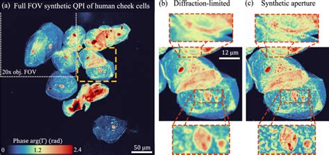 Comparison Of A The Diffractionlimited And B Synthetic Aperture