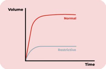 How To Interpret A Spirometry Test CardiacDirect