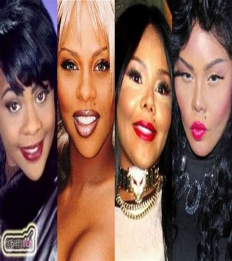 Of The Worst Celebrity Plastic Surgery Disasters