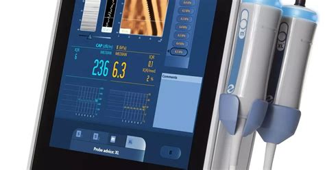 Fibroscan Detects Fatty Liver Disease Adventhealth Tampa