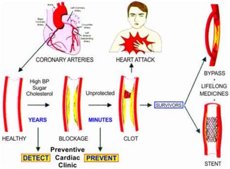 Heart Flow Chart Ponasa