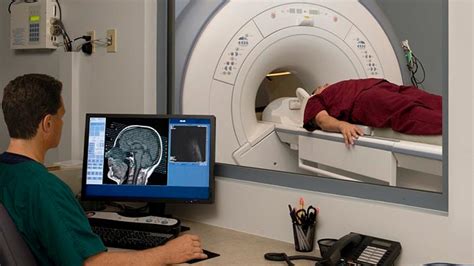 Resonancia Magnética De Cráneo Resobert Medicina And Radiología