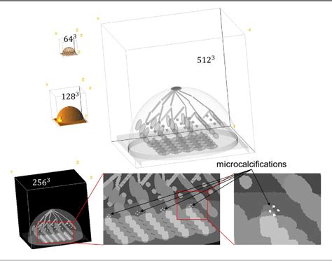 Figure 2 From A Realistic Breast Phantom Proposal For 3d Image Reconstruction In Digital Breast
