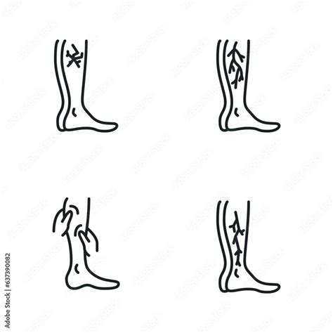 Varicose Treatment Icons Leg Veins Thrombosis Disease And Surgery