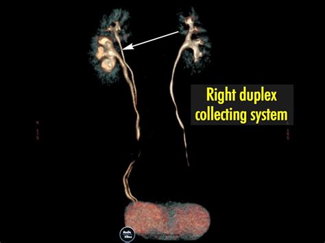 Radiology Vibes Online Learning Platform For Radiologists