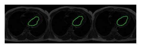 MR Images Left Ventricle Segmentation A Manual Delineation By