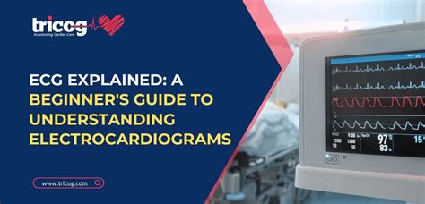 Ecg Explained A Beginner S Guide To Understanding Electrocardiograms