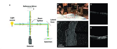 Optical Coherence Tomography And Elastography A Schematic Of Optical Download Scientific