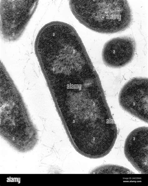 Transmission Electron Micrograph Of The Gram Positive Anaerobic Bacteria Clostridium Botulinum