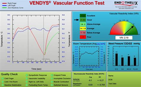 Physicians Vendys Ii