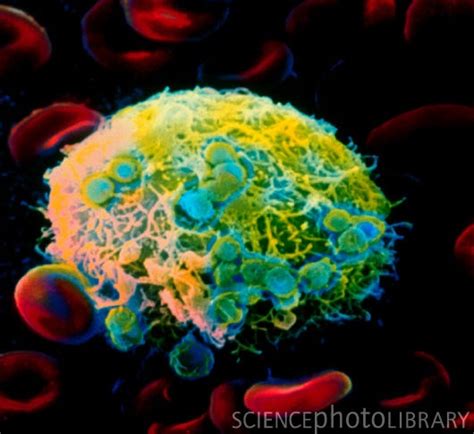 Coloured Sem Of A Megakaryocyte Bone Marrow Cell