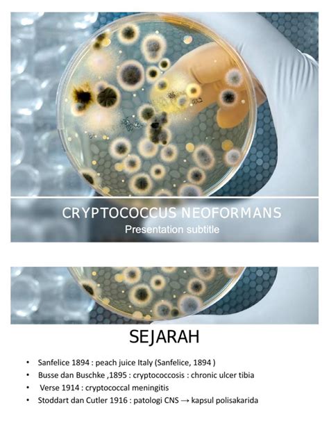 Cryptococcus Neoformans Pdf Fungus Immunology