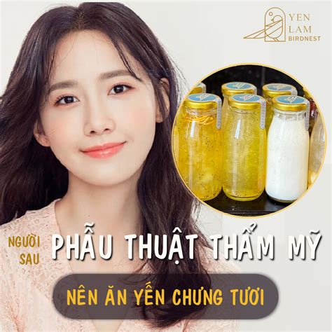 Cùng Yến Lam Tìm Hiểu Người Sau Phẫu Thuật Thẩm Mỹ Ăn Yến Chưng Tươi Có