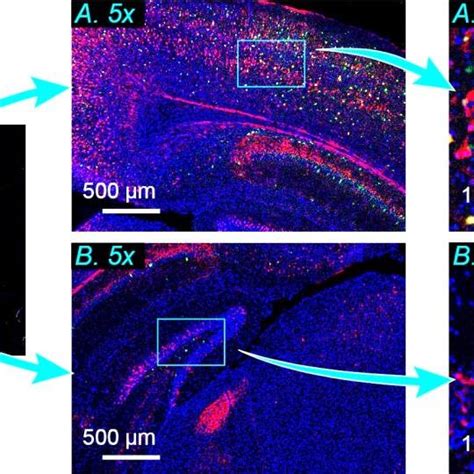 Imaging Of Mouse Brain Slice Download Scientific Diagram