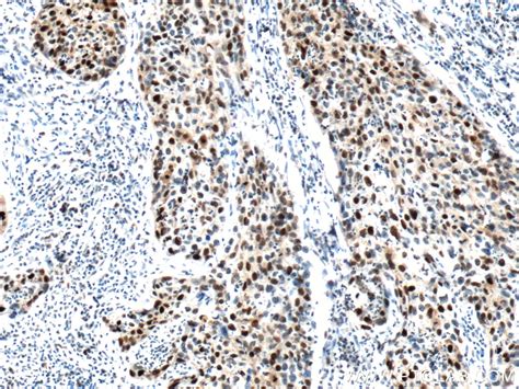 P21 Rabbit Polyclonal Antibody United Bio Research