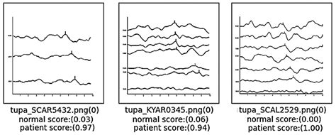 Performance Comparison Of Convolutional Neural Network Based Hearing