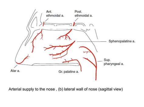 Embolization For Epistaxis Ppt First Aid Injuries