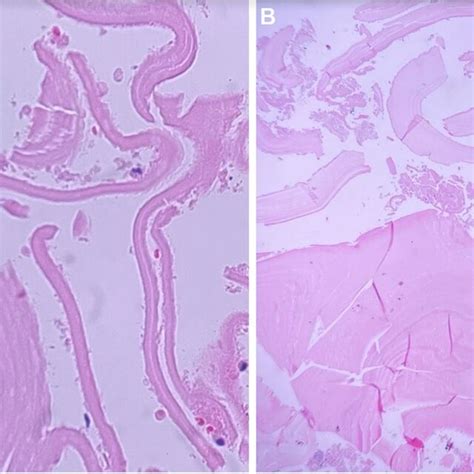 Low Magnification Photomicrograph Of The Biopsy Specimen With Download Scientific Diagram