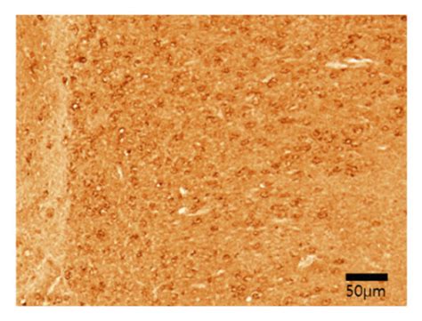 Effect Of Ttk On Expression Of Neun Positive Cells In The Prefrontal