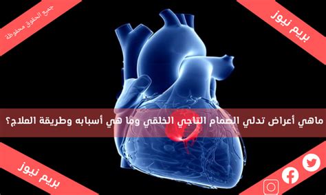 ماهي أعراض تدلي الصمام التاجي الخلقي وما هي أسبابه وطريقة العلاج