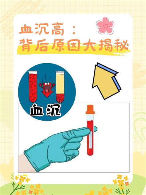 血沉高背后原因大揭秘 妙手医生