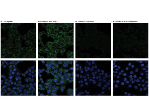 Phospho Atg Ser D B M Rabbit MAb Cell Signaling Technology