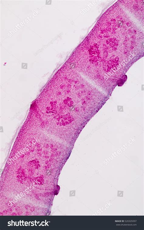 Taenia Solium Parasite Under Microscope Stockfoto Nu Bewerken 520329397