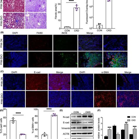 M1 Macrophage Activated With Emt In The Unilateral Ureteral Obstruction Download Scientific