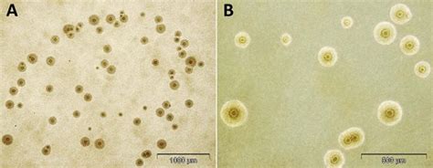 Mycoplasma Hominis Laboratory Diagnosis Sample Transport Microscopy Culture Serodiagnosis