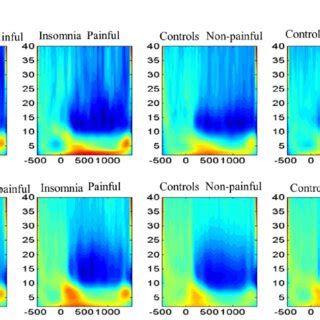 EEG Power Responses A Grand Averaged Power Is Produced By Painful And Download Scientific