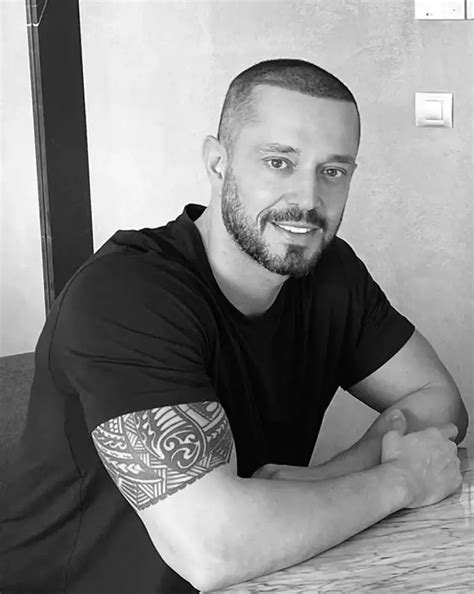 Murat Boz Saç Ekimi Yoksa Protez Saç Mı Kardelen Tıp Merkezi